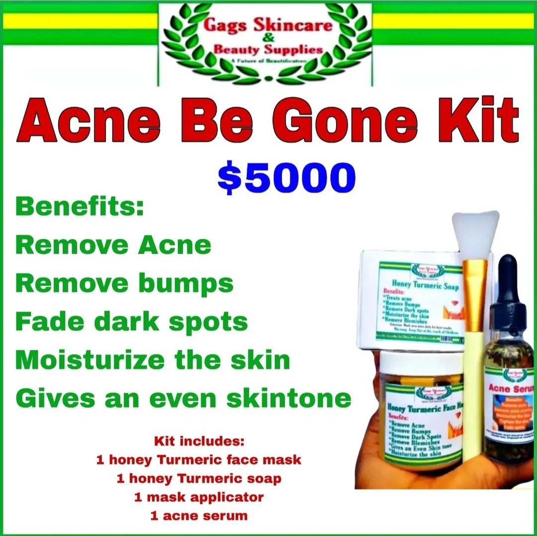 Acne Be Gone Kit